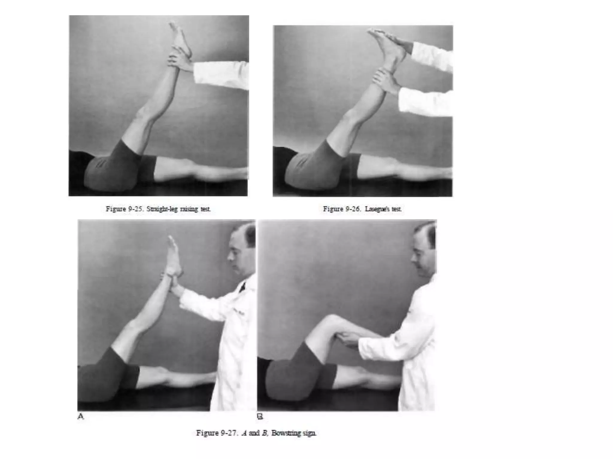 INTERVERTEBRAL DISC ANATOMY AND PIVD OF LUMBAR SPINE AND ITS MANAGEMENT ...