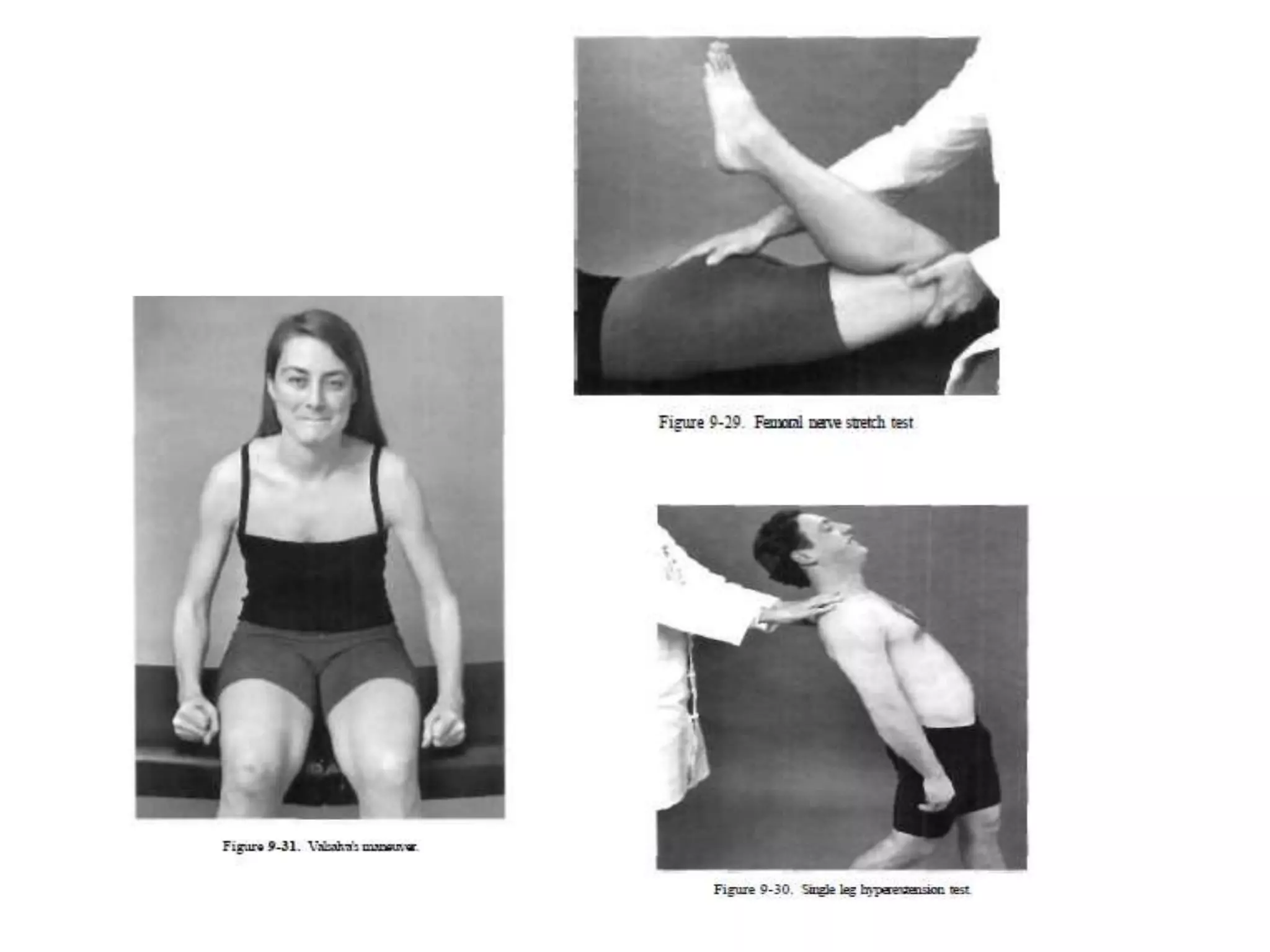 INTERVERTEBRAL DISC ANATOMY AND PIVD OF LUMBAR SPINE AND ITS MANAGEMENT ...