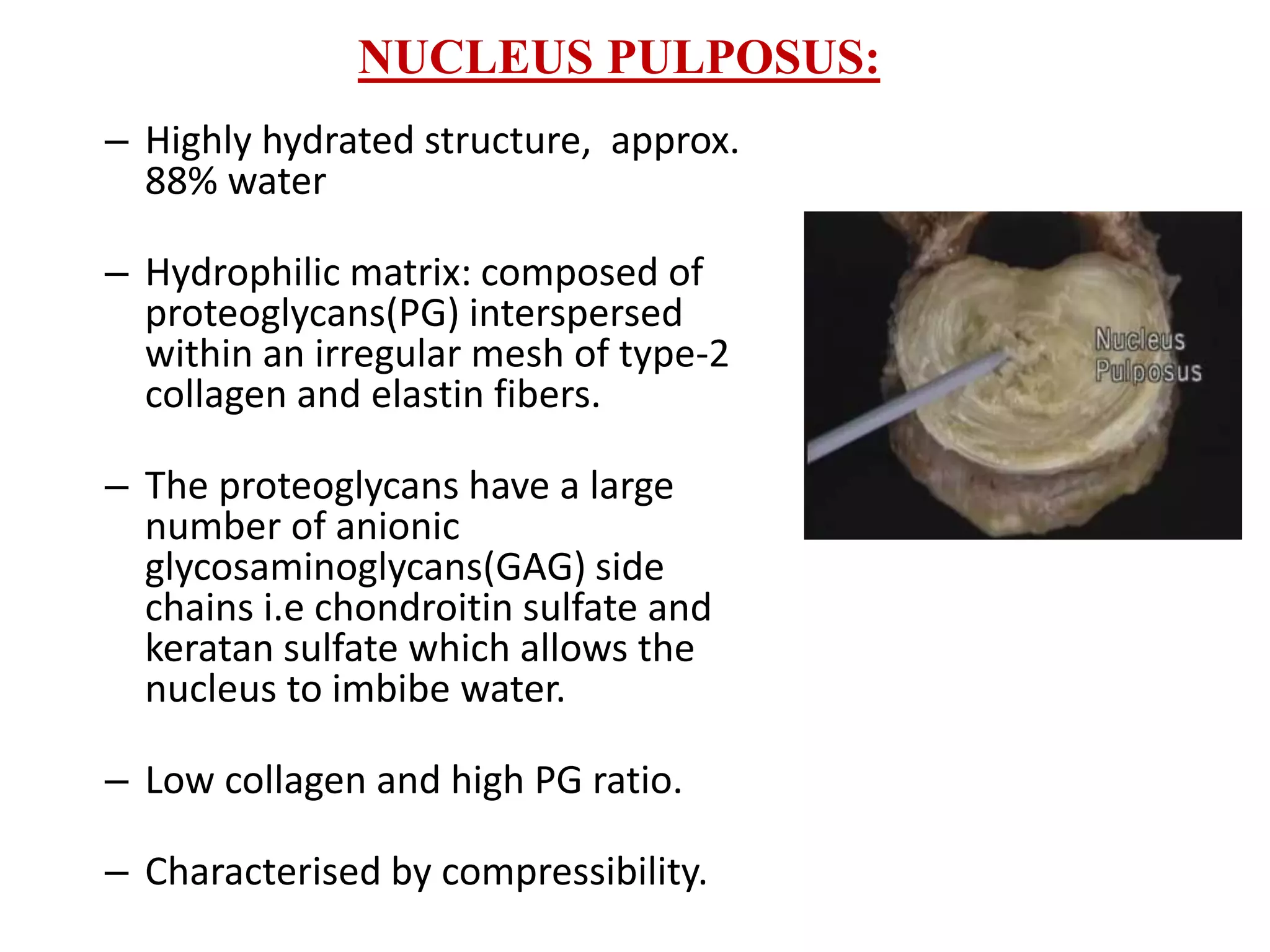 INTERVERTEBRAL DISC ANATOMY AND PIVD OF LUMBAR SPINE AND ITS MANAGEMENT ...