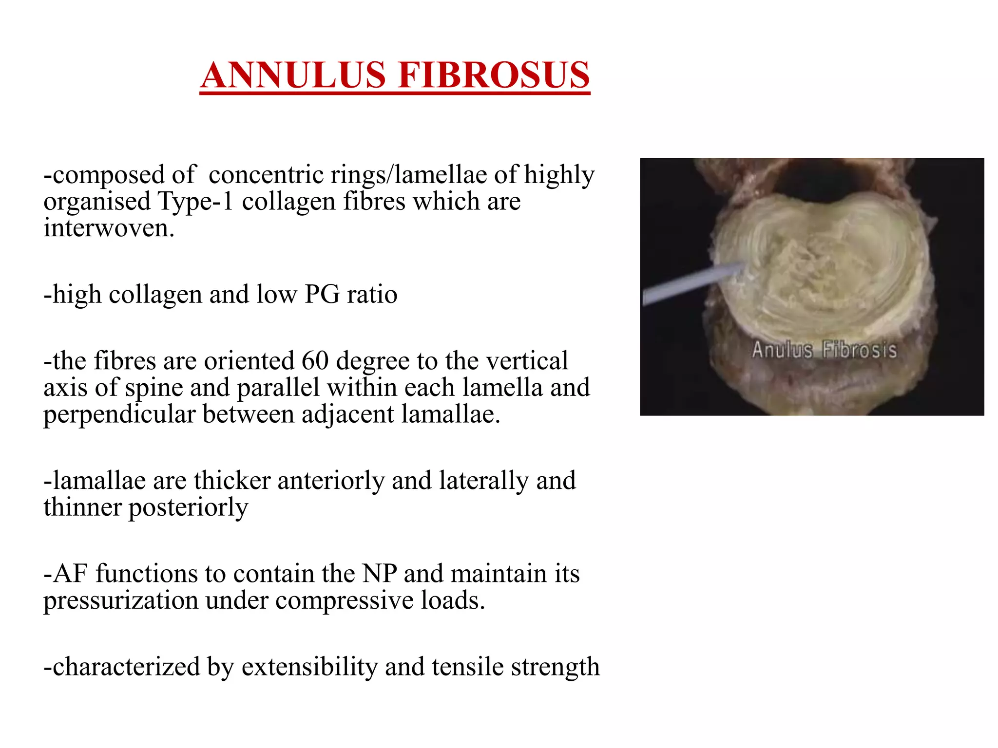 INTERVERTEBRAL DISC ANATOMY AND PIVD OF LUMBAR SPINE AND ITS MANAGEMENT ...