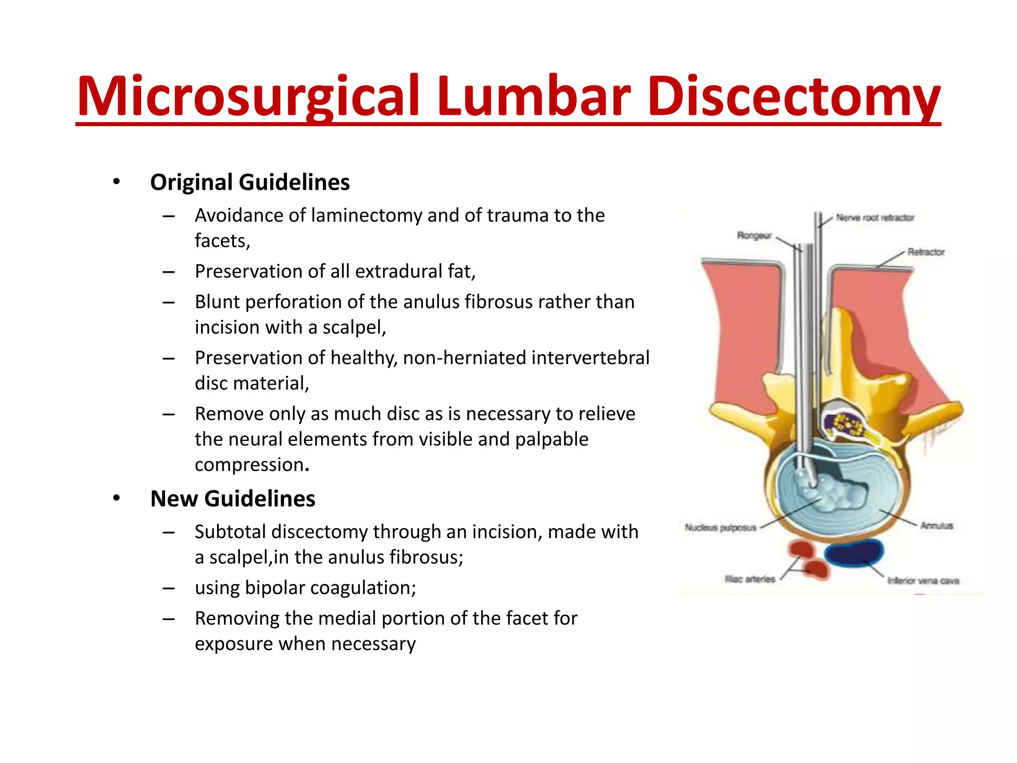 INTERVERTEBRAL DISC ANATOMY AND PIVD OF LUMBAR SPINE AND ITS MANAGEMENT ...