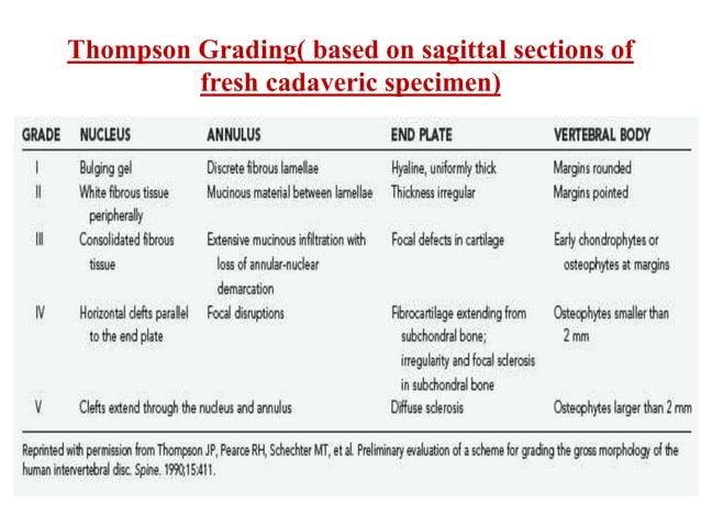 INTERVERTEBRAL DISC ANATOMY AND PIVD OF LUMBAR SPINE AND ITS MANAGEMENT ...