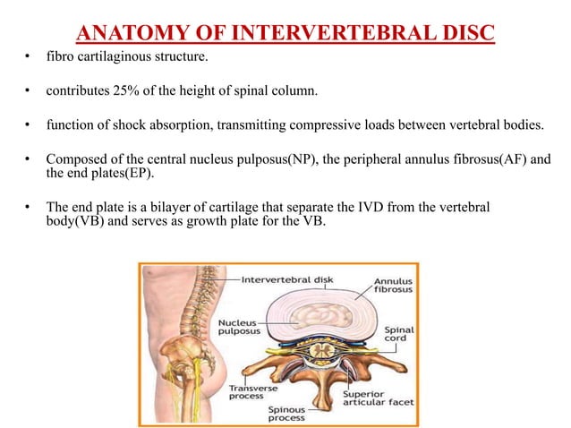 INTERVERTEBRAL DISC ANATOMY AND PIVD OF LUMBAR SPINE AND ITS MANAGEMENT ...