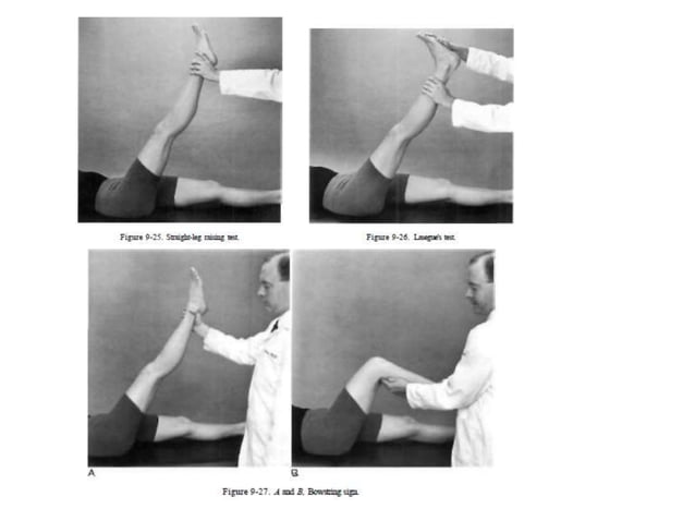 INTERVERTEBRAL DISC ANATOMY AND PIVD OF LUMBAR SPINE AND ITS MANAGEMENT ...