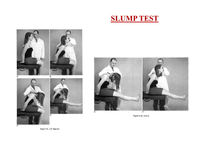 INTERVERTEBRAL DISC ANATOMY AND PIVD OF LUMBAR SPINE AND ITS MANAGEMENT ...