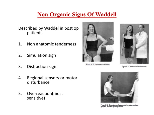 INTERVERTEBRAL DISC ANATOMY AND PIVD OF LUMBAR SPINE AND ITS MANAGEMENT ...