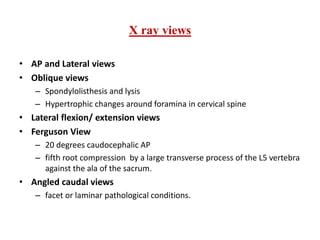 INTERVERTEBRAL DISC ANATOMY AND PIVD OF LUMBAR SPINE AND ITS MANAGEMENT ...