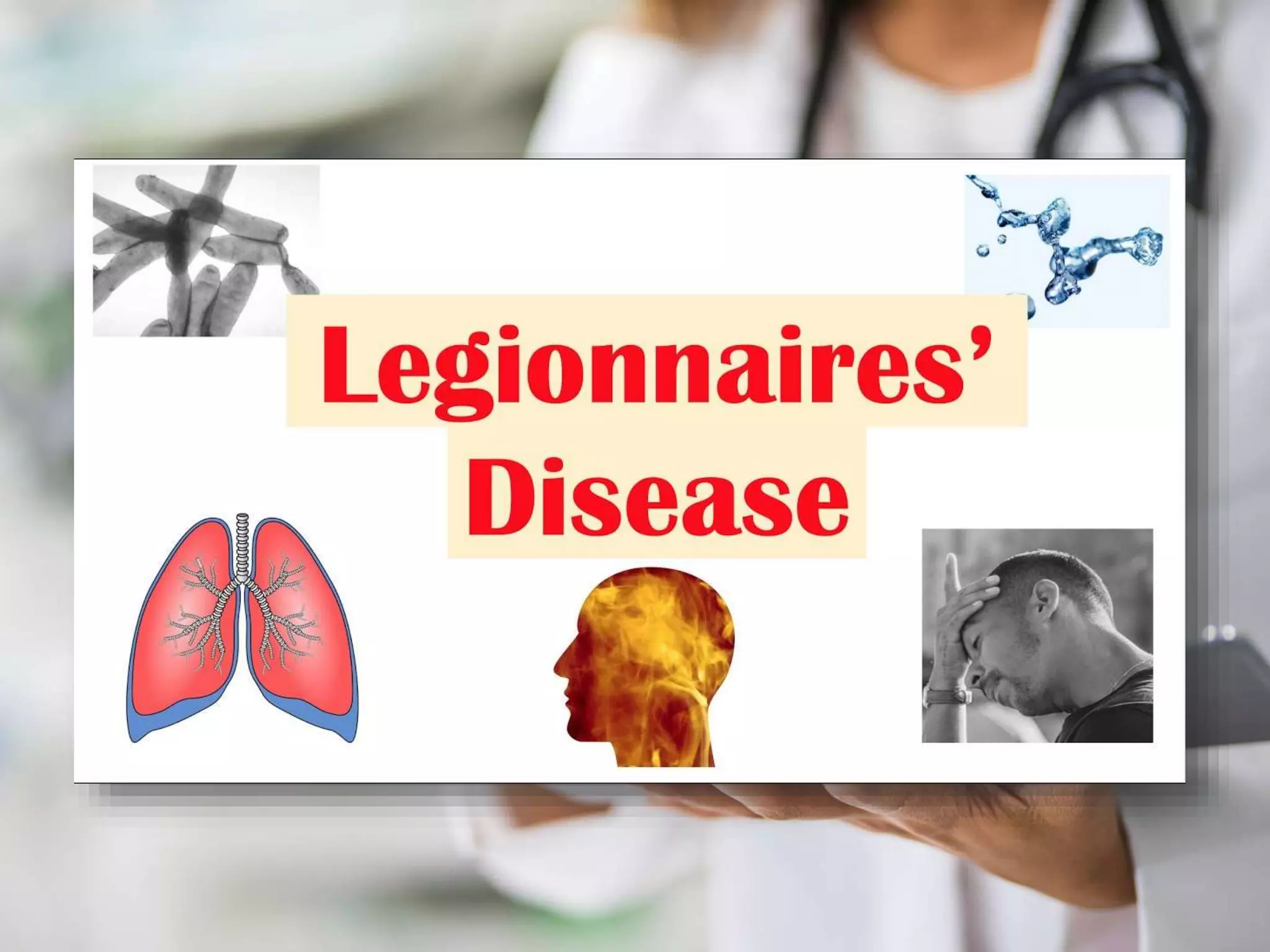 Pharmacovigilance of Levofloxacin on Legionnaries Disease. | PPT