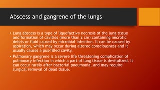 Suppurative lung diseases | PPT
