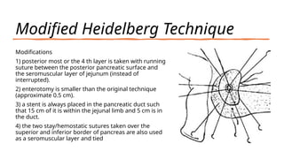 PJ.pptx Outer layer interrupted ( 4-8) transpancreatic sutures using ...