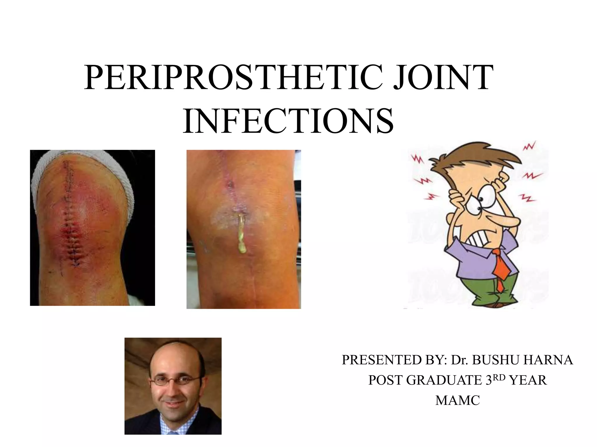 Periprosthetic Joint Infection | PPTX