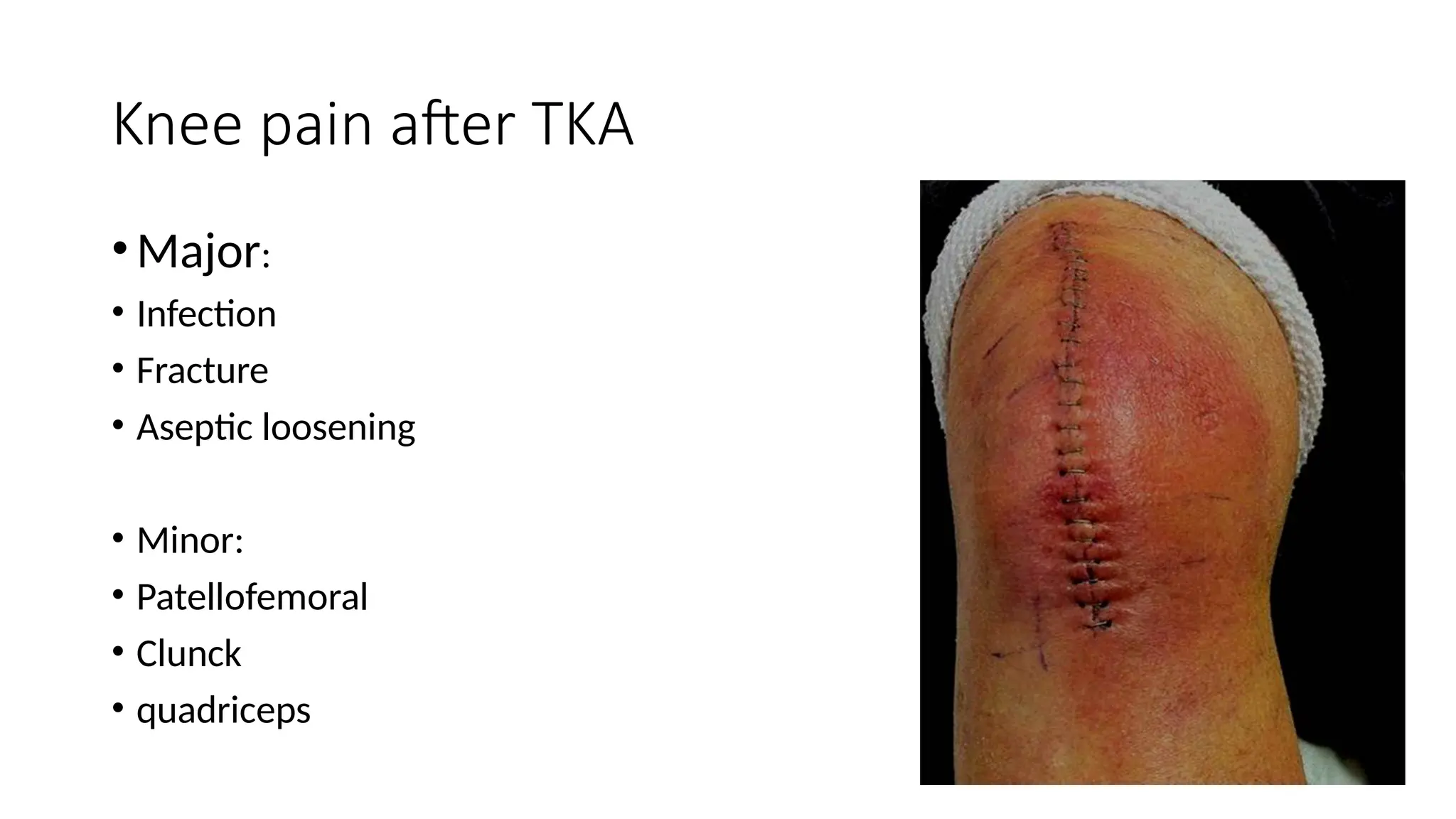 periprosthetic joint infection in the knee and hip.pptx