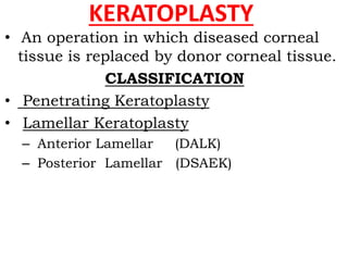 Penetrating keratoplasty in ophthalmology | PPTX