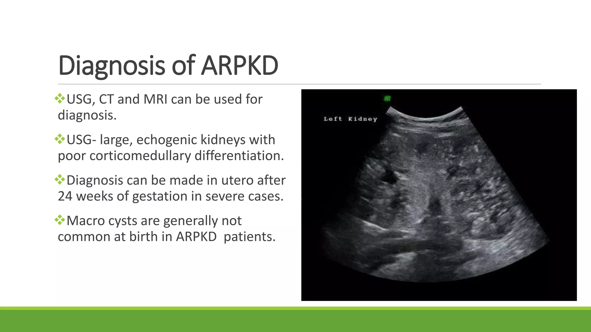 Polycystic Kidney Disease | PPTX