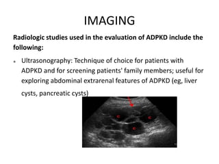 Polycystic Kidney disease | PPTX