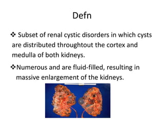 Polycystic Kidney disease | PPTX