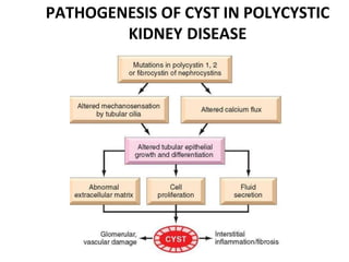 Polycystic Kidney Disease Pathophysiology