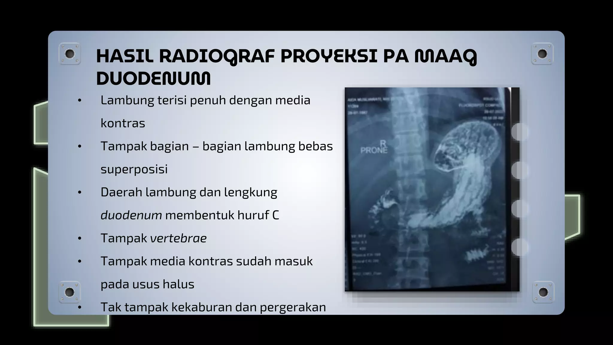 PKL II TEKNIK PEMERIKSAAN OMD KLINIS GERD.pptx