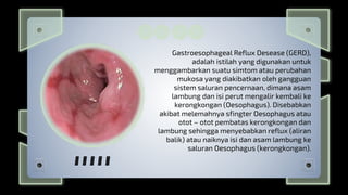 PKL II TEKNIK PEMERIKSAAN OMD KLINIS GERD.pptx