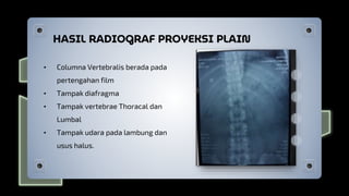PKL II TEKNIK PEMERIKSAAN OMD KLINIS GERD.pptx