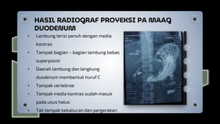 PKL II TEKNIK PEMERIKSAAN OMD KLINIS GERD.pptx