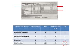 Pk pd analysis and mic interpretation in microbiological reports | PPTX