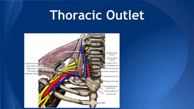 Thoracic outlet | PPTX