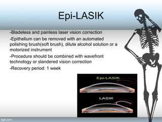REFRACTIVE SURGERY | PPT