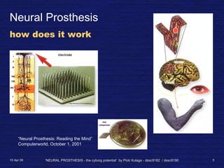 Neural Prosthesis - the cyborg potential | PPT