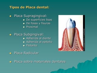 Placa bacteriana y caries dental | PPTX