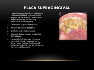 Placa dental (biofilm) | PPTX