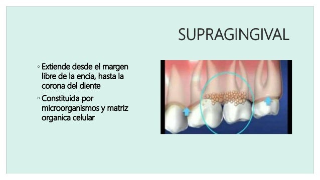 Placa dentobacteriana y_calculo_dental