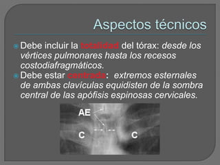 Guía simple para la radiografía de tórax | PPT
