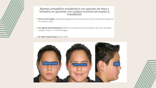Placas Swartz. historia,ventajas, desventajas, indicaciones | PDF