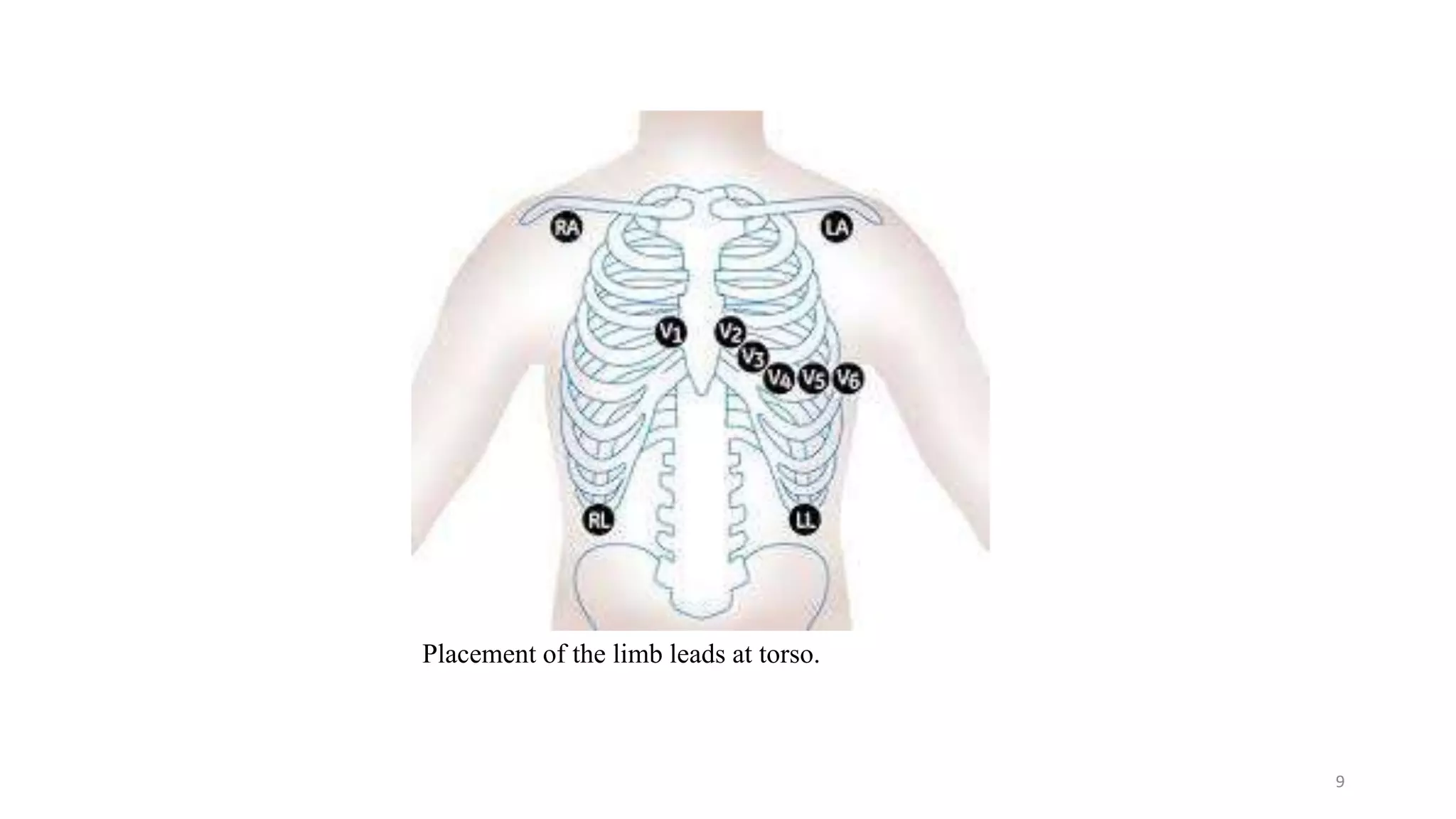 Placement of ecg leads during exercise (cardio ppt) | PPTX
