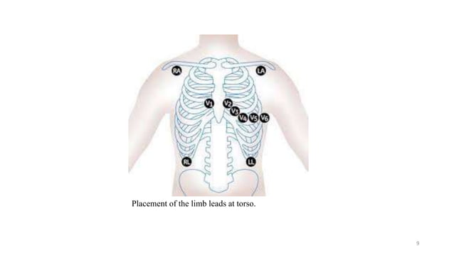 Placement of ecg leads during exercise (cardio ppt) | PPTX | Heart and ...