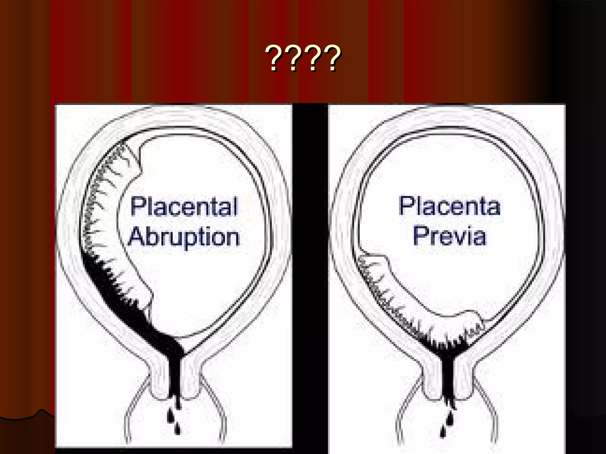 placenta-140315062308-phpapp01.pdf