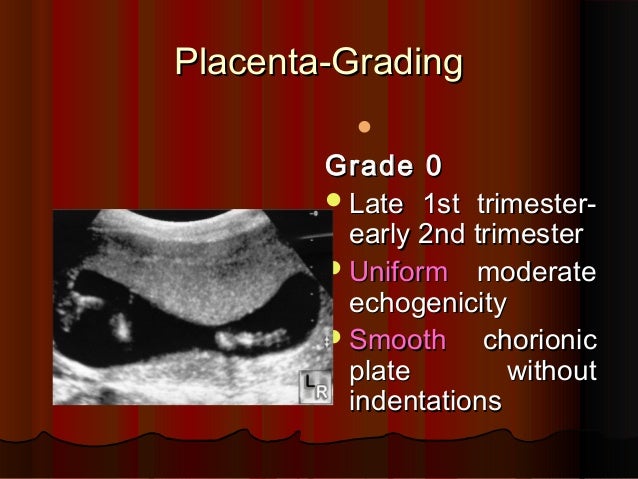 Placenta ultrasound