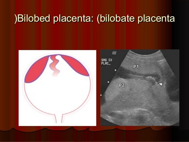 Placenta ultrasound