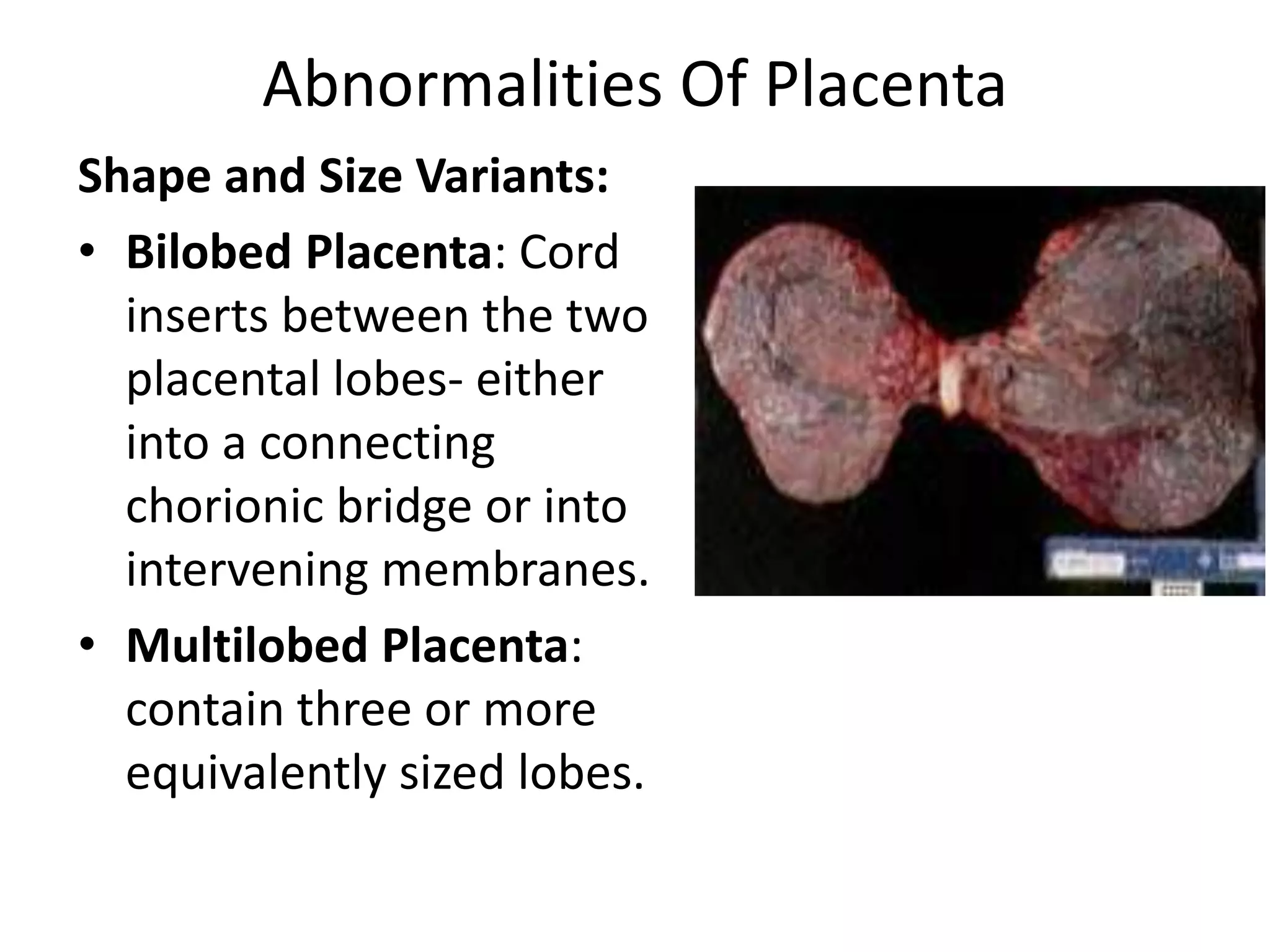 Placenta development and its abnormalities | PPTX