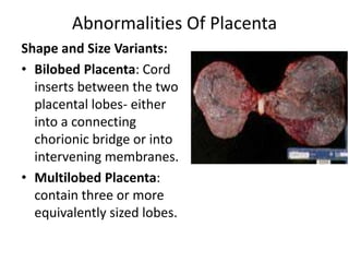 Placenta development and its abnormalities | PPTX