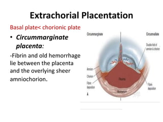 Placenta Circummarginate