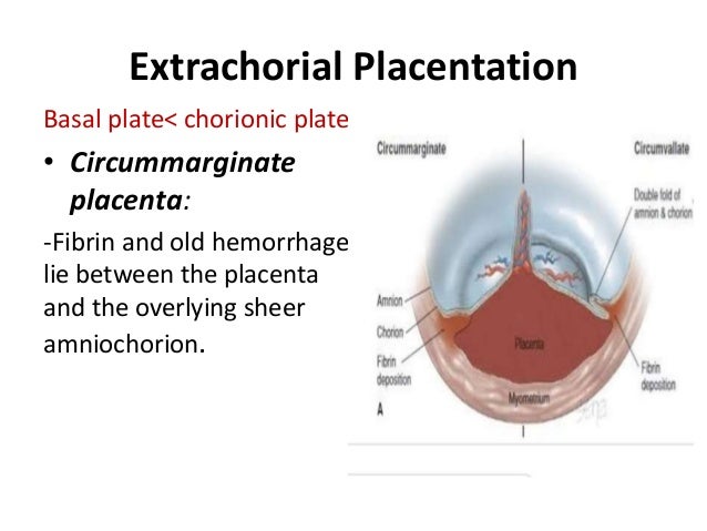 Zonary Placenta Attachment