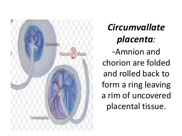 Placenta development and its abnormalities