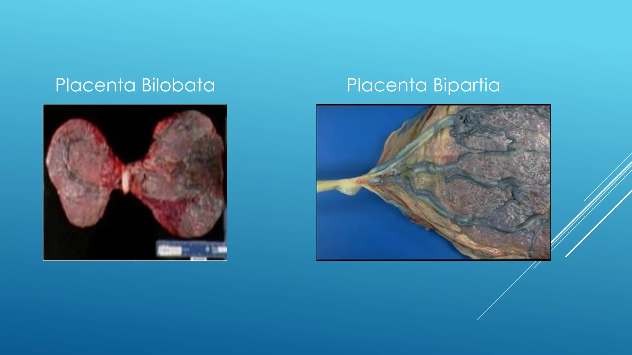 powerpoint presentation on placenta-2.pdf