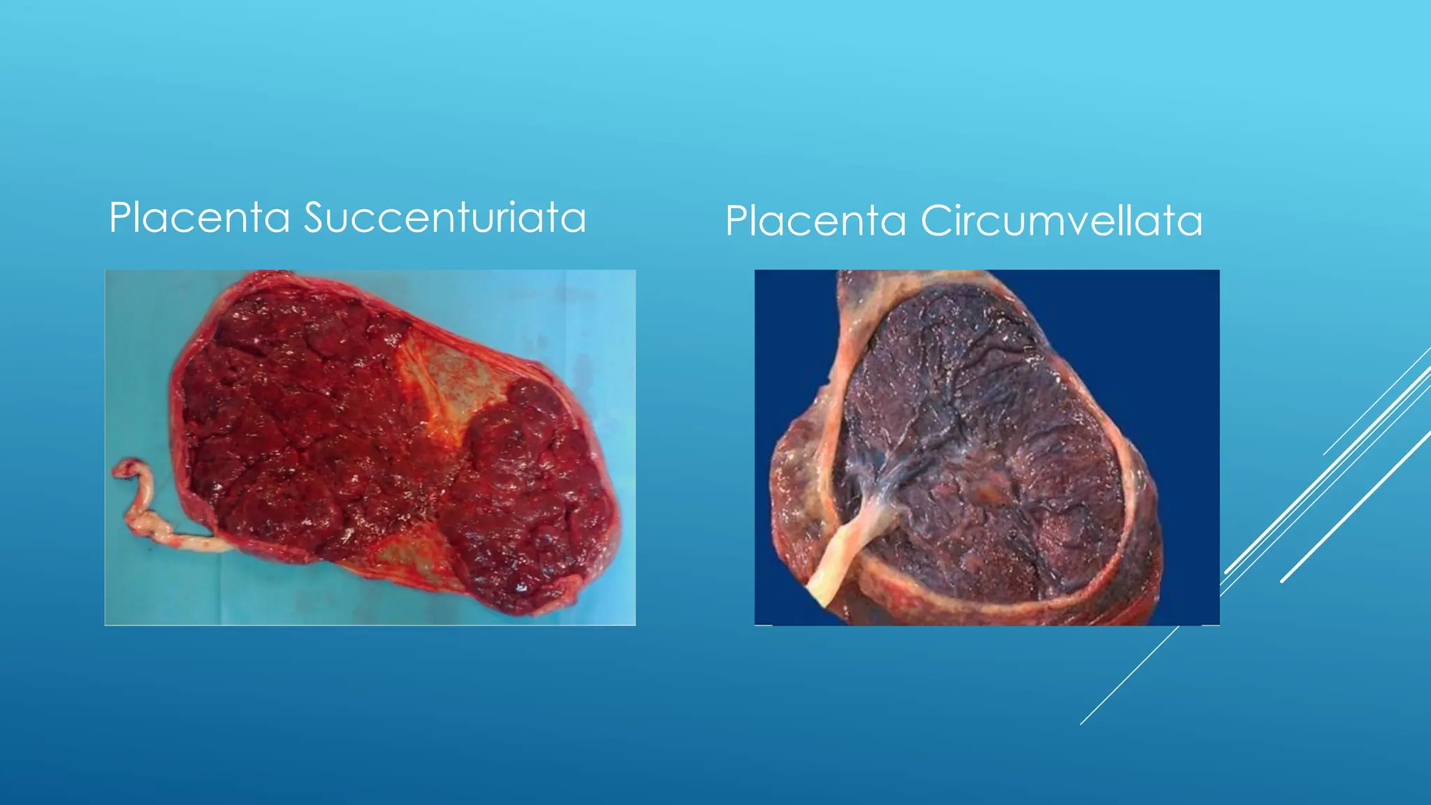 powerpoint presentation on placenta-2.pdf