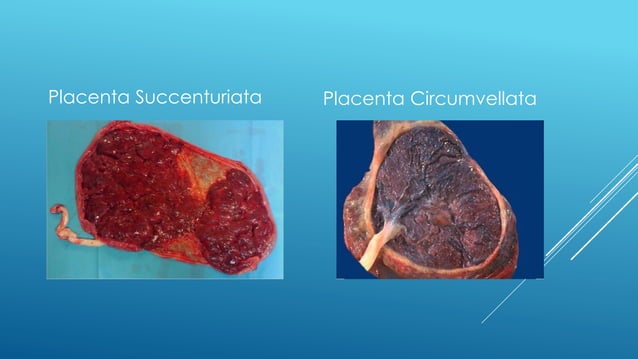 powerpoint presentation on placenta-2.pdf