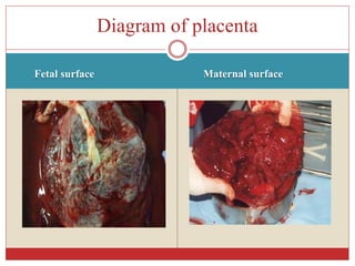 Structure and Function of Placenta | PPTX