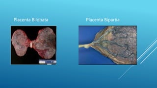 Placenta | PPTX