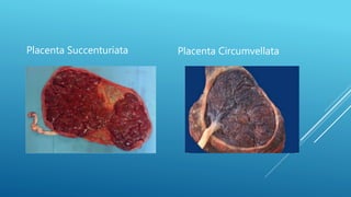 Placenta | PPT